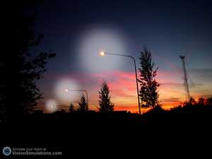 Halos And Starbursts Around Lights And Vision Correction | Barrett ...