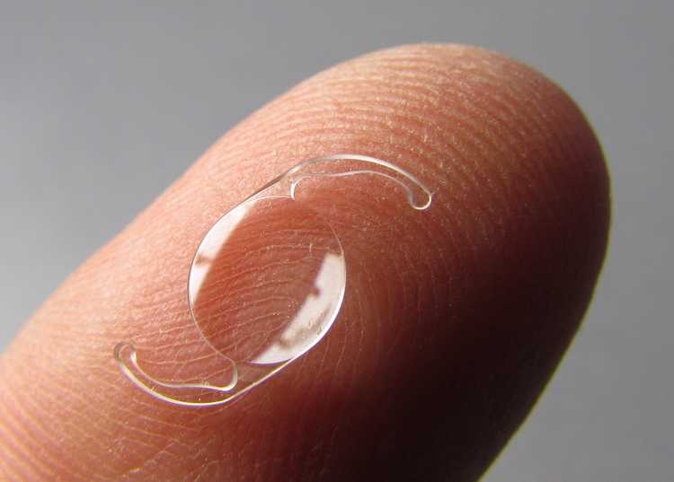 This Is How The New Lens Stays In The Eye After Cataract Surgery ...