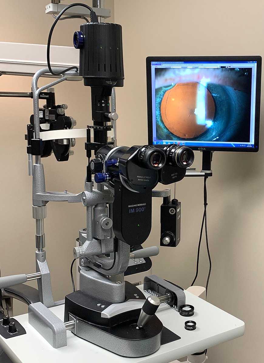 How To Tell Are Eye Floaters Normal Or Harmful | Barrett Eubanks, M.D.
